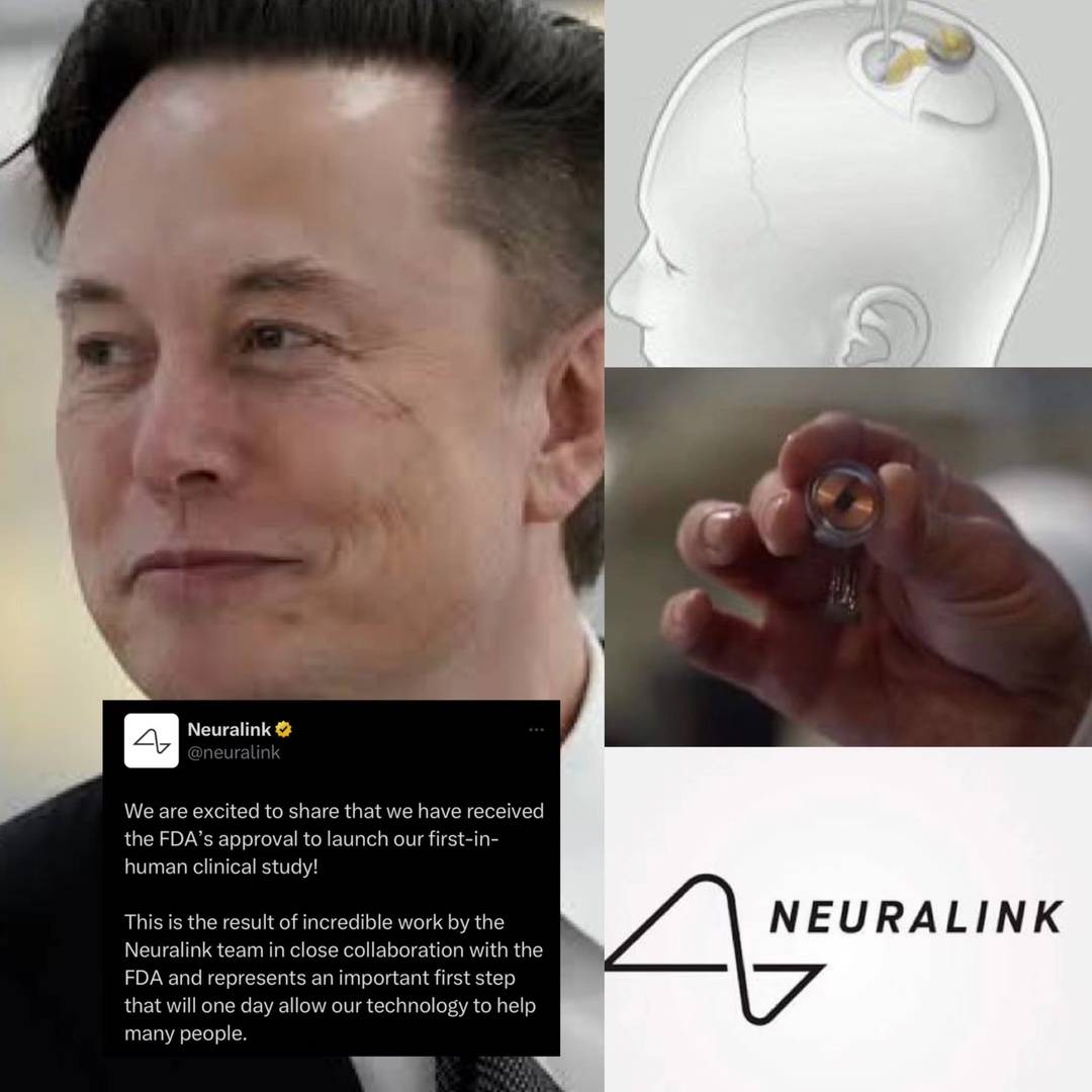 马斯克的脑机接口公司neuralink官宣:首次人体临床试验获fda批准